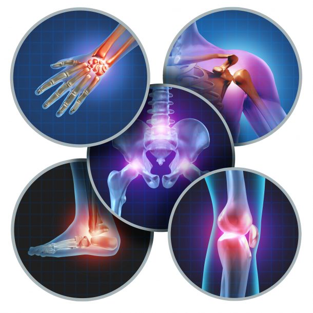 Acupuncture for Pain - Innovative Healing Center